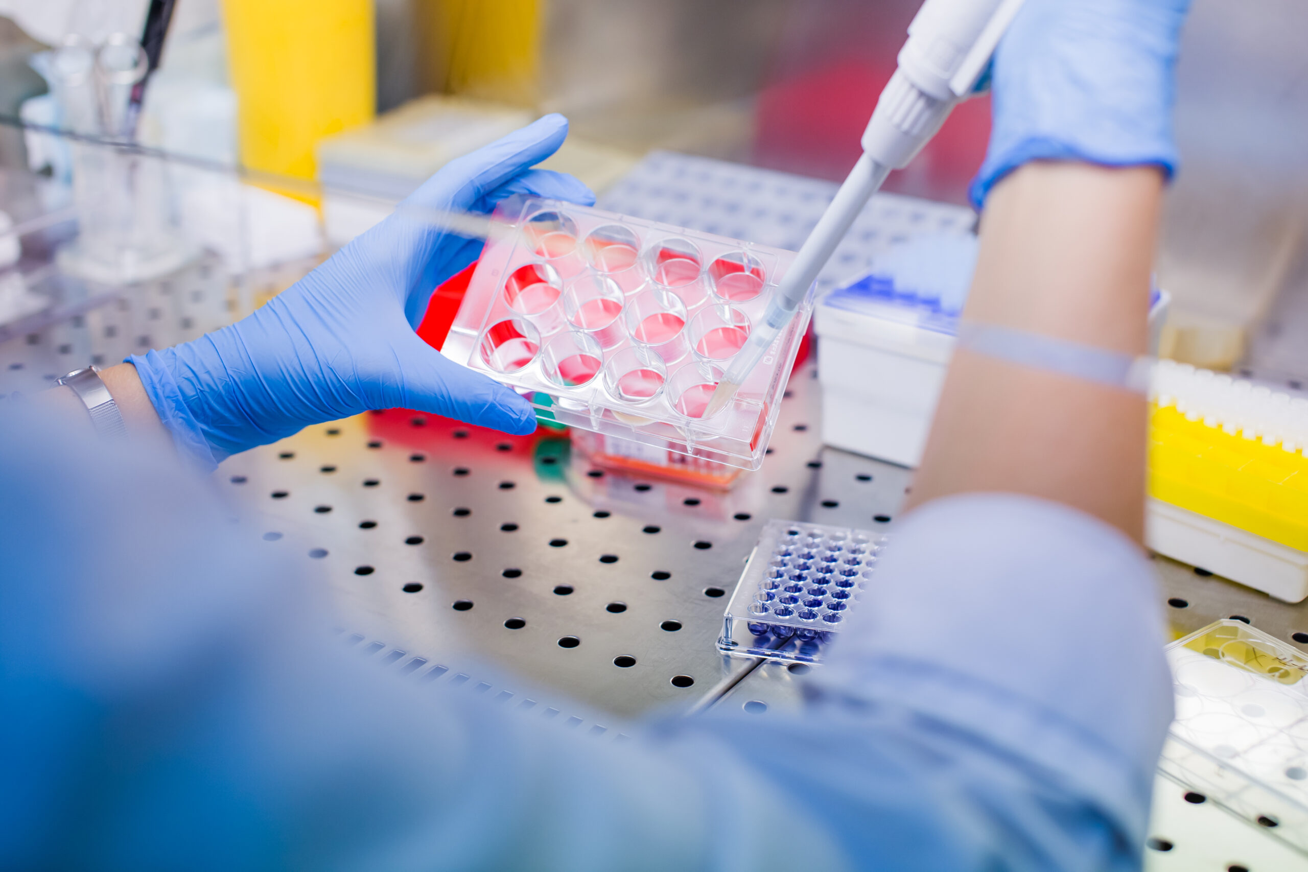 In Vitro Intestinal Model for GI Safety Explained - Altis Biosystems